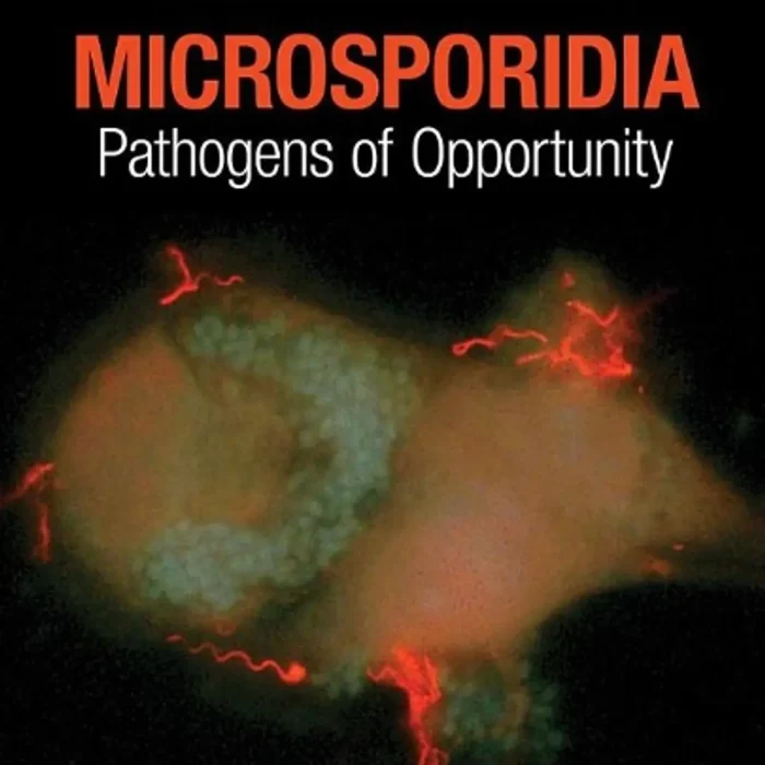Microsporidia Pathogens of Opportunity - Medical Book Store Uae