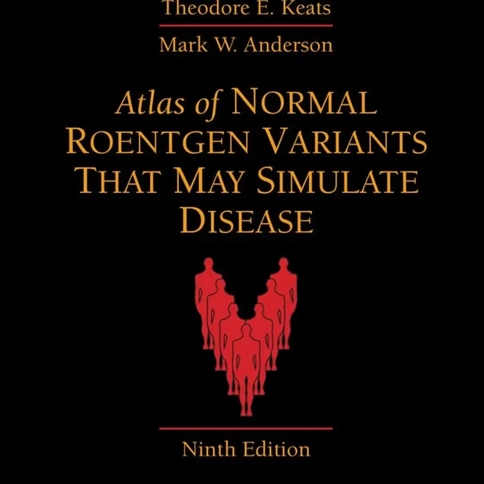 Atlas of Normal Roentgen Variants That May Simulate Disease - Medical ...